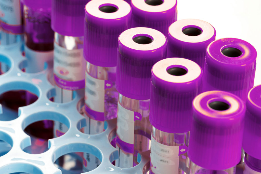 COV-19 IDx True High Throughput Testing: Developed by an Agile and ...